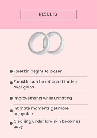 Phimosis Stretching Rings (20 Rings set) With fore-stretch phimosis cr ...